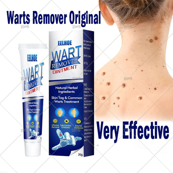 EELHOE Warts Remover Original Cream painless Wart remover Ointment 20g ...