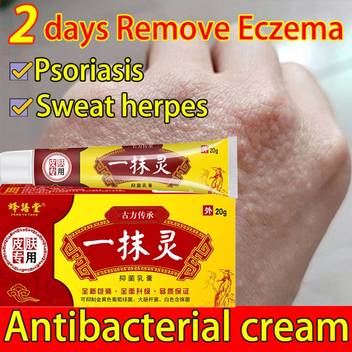 [Ready Stock- E:2026/27]Yimoling Skin Itching Antibacterial Cream Hands ...