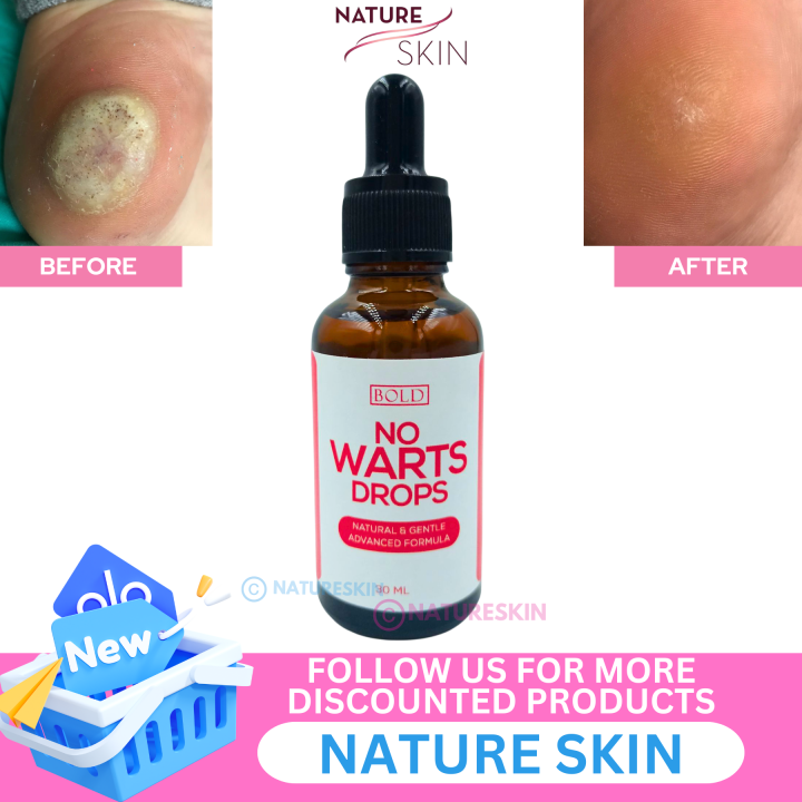 No Warts Drop 30ml for Skin tags Mole Remover Anti bacterial Kulogo ...