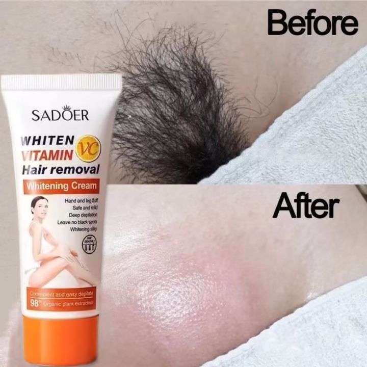 Hair removal cream side effects store