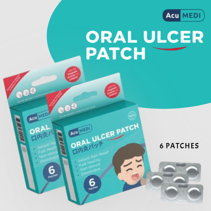 AcuMedi Oral Ulcer Instant Relief Patch (6 patches/box) Mouth Ulcer Treatment Ulcer Pain Relief ...