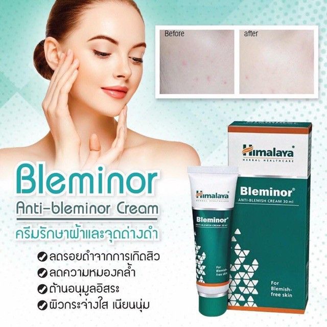 ครีมรักษาฝ้ากะและจุดด่างดำ รอยแกะสิว Himalaya Bleminor 30 ml | Lazada.co.th