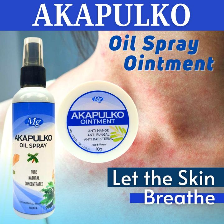 MG AKAPULKO OIL SPRAY 100ML & OINTMENT 10G Pure Herbal Rash Cream ...