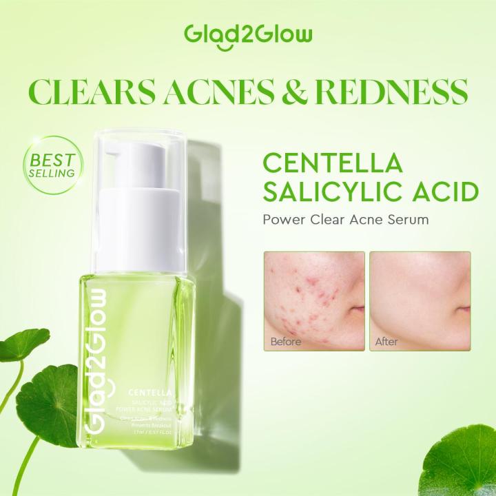 [G2G] Glad2Glow Centella Aslicylic Acid Power Acne Serum Salicylic Acid ...