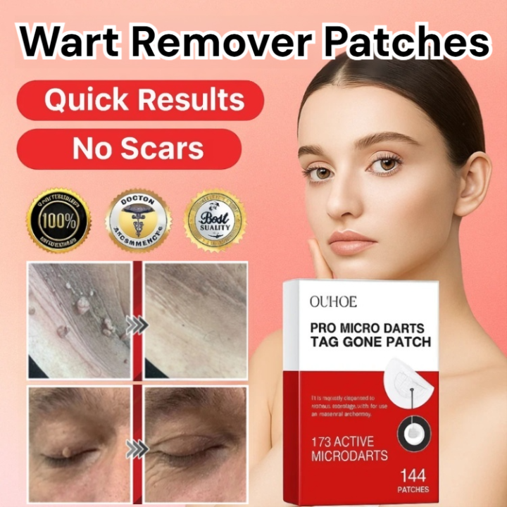 Plant-based Wart Removal Patch Pads Corn Remover Face Moles Sticker ...