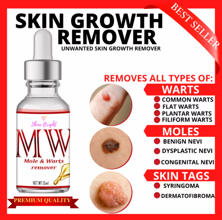 Premium Quality Warts Skin Tags Mole Kulugo Kalyo Remover Pure Kasoy ...