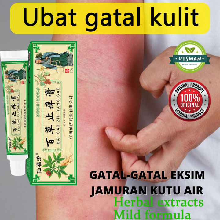 Ubat gatal kulit Cream gatal 止癢膏 20g skin Antibacterial skin wet poison ...