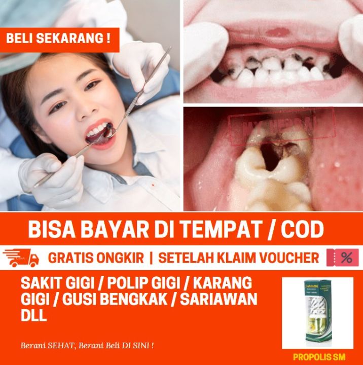 Obat Gigi Berlubang, Obat Perontok Gigi Berlubang, Sakit Gigi Disertai Sariawan, Penghancur Gigi ...