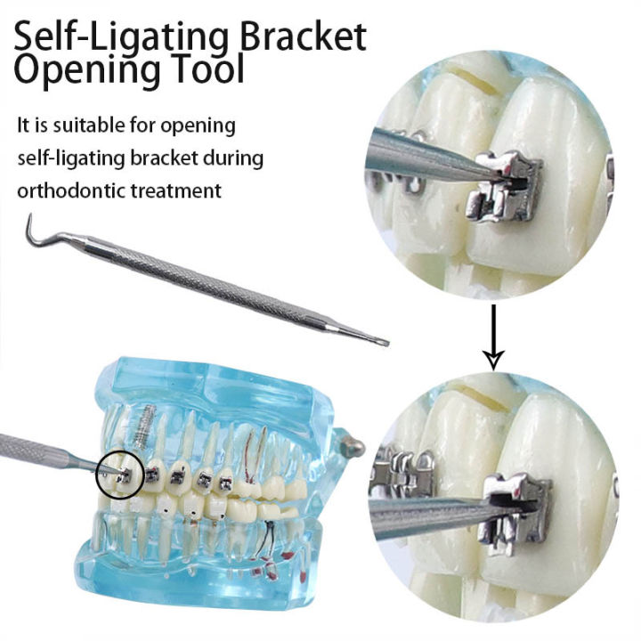 Dental Bracket Opener Tool For Opening Orthodontic Self Ligating ...
