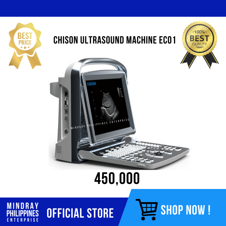 CHISON ULTRASOUND MACHINE | Lazada PH