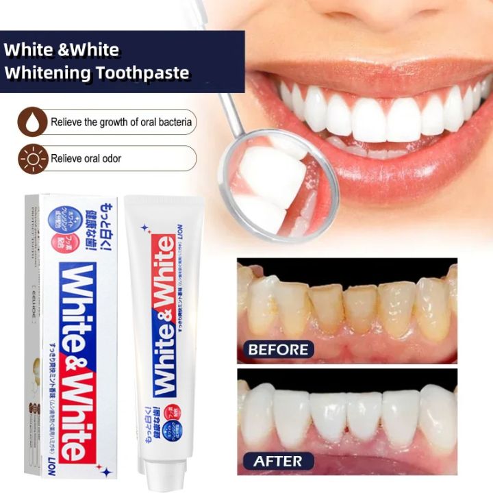 Japan Lion Toothpaste White Dental Whitening Strengthen Teeth Remove Smokers Stains Remove ...