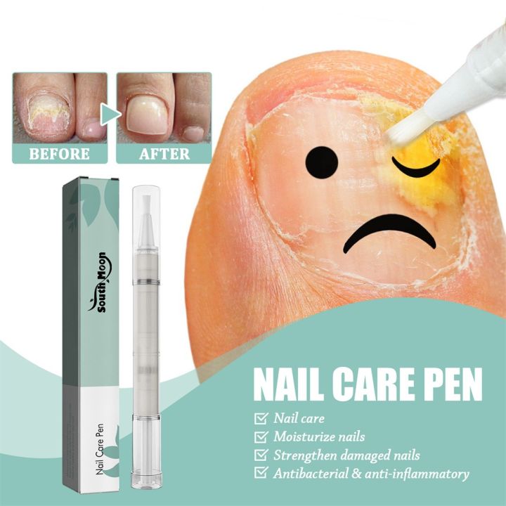 HANBI💝 Nail Fungal Treatment Pen Anti Fungus Infection Biological ...