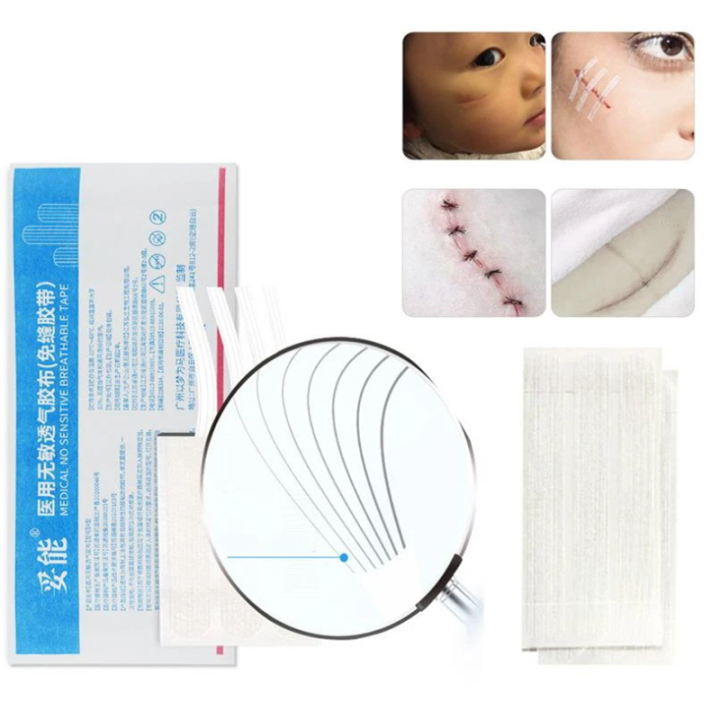 10/6pcs Medical Surgical Tape Without Sutures Skin Sterile Wound ...