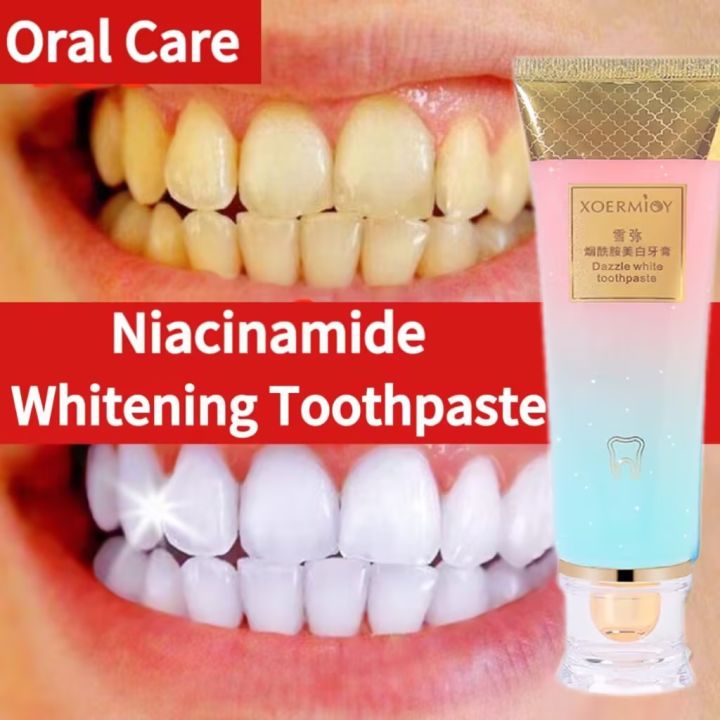 Niacinamide Whitening Toothpaste Remove Stains Fresh Breath Bright Teeth Teeth Whitening Tartar ...