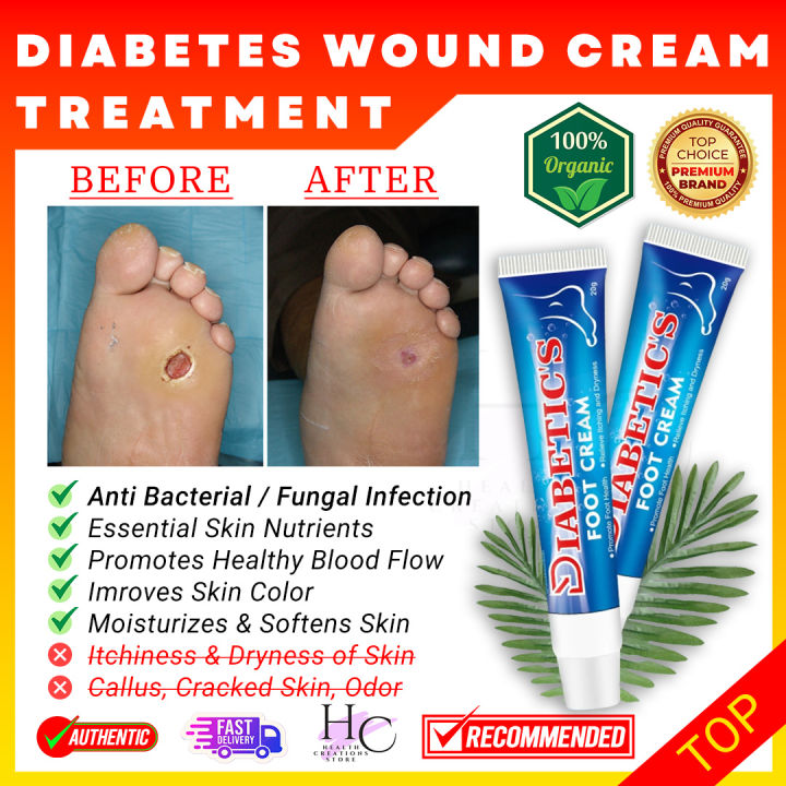 SUMIFUN diabetic wound ointment diabetic wound healing ointment ...