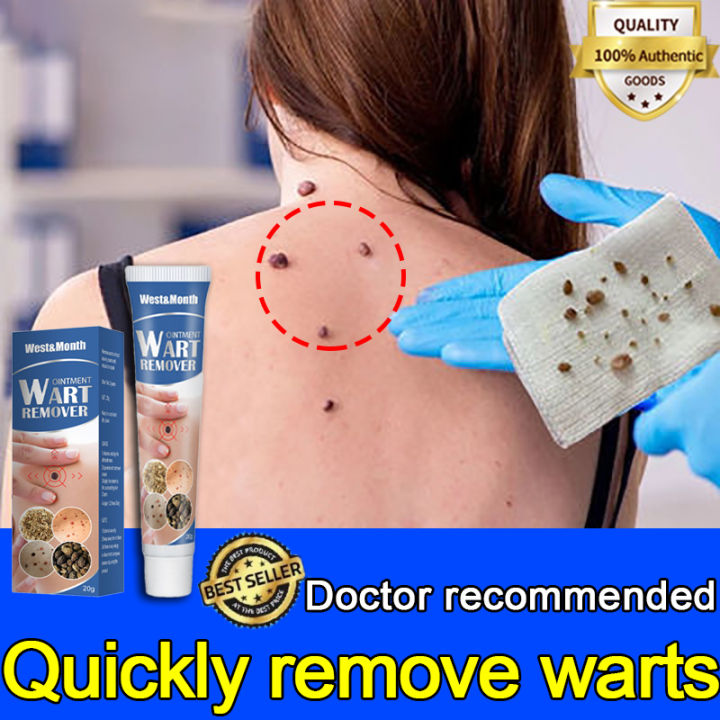 20g Original Wart Removal Ointment Fast Remove Skin Tag Remover ...