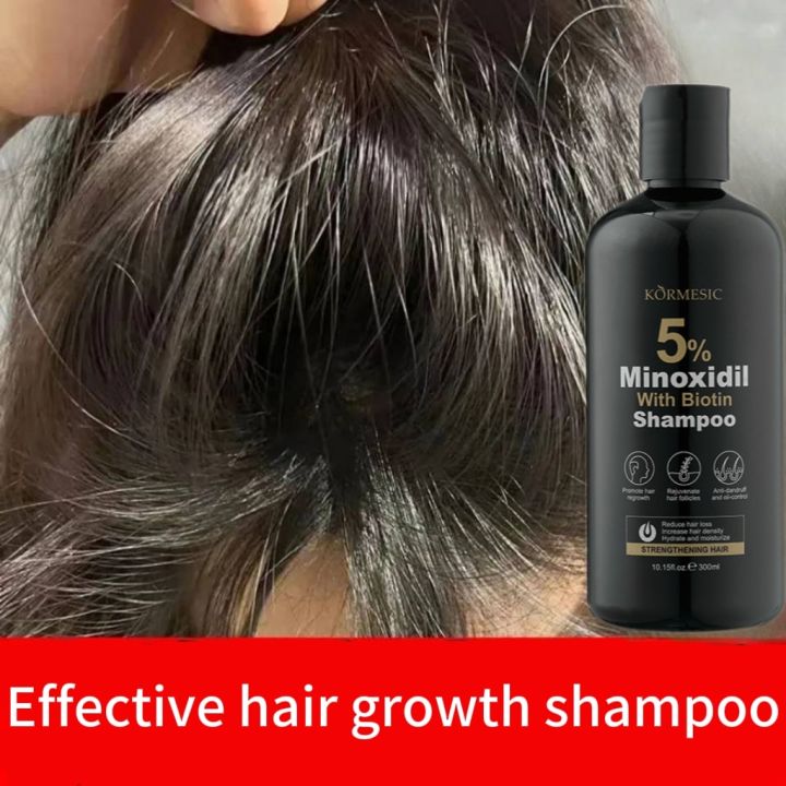 Minoxidil Hair shampoo Anti Hair Loss Nourish Hair Fast Growth Shampoo Oil Control Anti-Dandruff ...