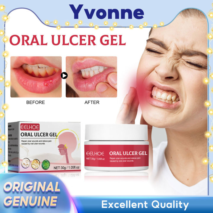 EELHOE Oral Ulcer Gel Relieve Swollen Gum Gel Oral Care Pain Relief ...