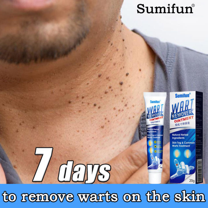 【SUMIFUN】Warts Remover Original Cream Warts Magic Remover Wartz Removal ...