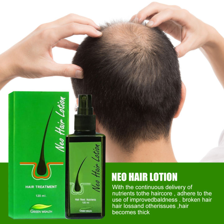 Neo Hair Lotion Clinically Proven Hair Thickening Hair Loss Prevention ...