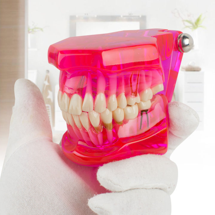 Dental Tooth Teeth Model Adult Model For dental lab Study Pink | Lazada PH
