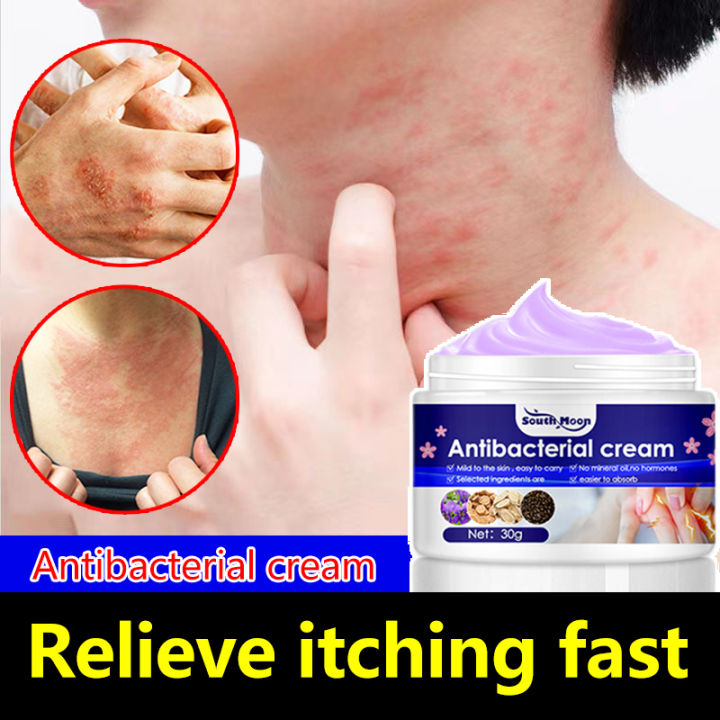 Antibacterial cream 30g Skin Rash Cream Skin Herbal Psoriasis ...