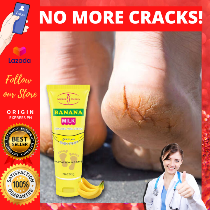 PANTANGGAL NG KALYO SA PAA – AUTHENTIC Banana Milk Foot Cracked Cream ...
