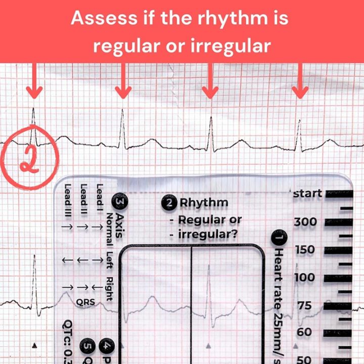 KEUMK-ECG 7 Step Ruler, ECG 7 Step Ruler for ECG/EKG Interpretation ...