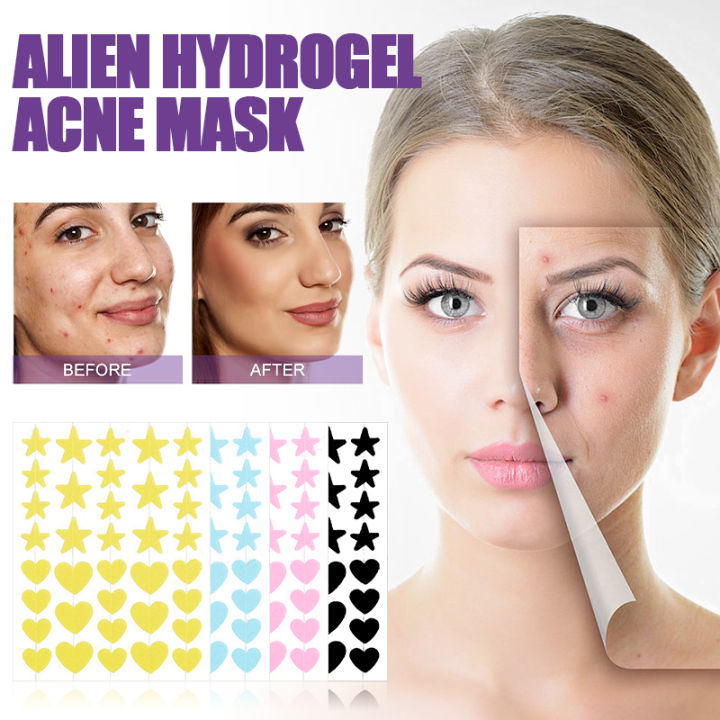 NYL 36PCS/Sheet Acne Pimple Patch Salicylic Acid Acne Treatment ...