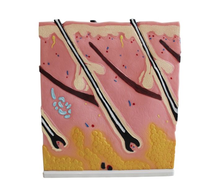 Observation and discovery of human skin structure model in children's ...