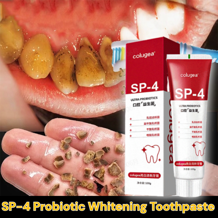 SP-4 Probiotic Toothpaste 120g Whitening Teeth Remove Yellow Tartar ...