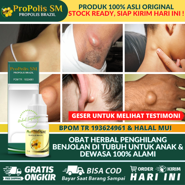 Propolis SM - Propolis Brazil Original Obat Kelenjar Getah Bening, Obat ...