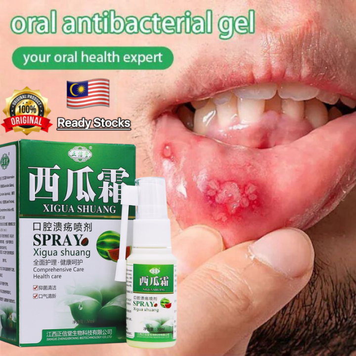 【Ready Stock】西瓜霜喷剂 toothache pain reliever watermelon frost spray 20ml ...