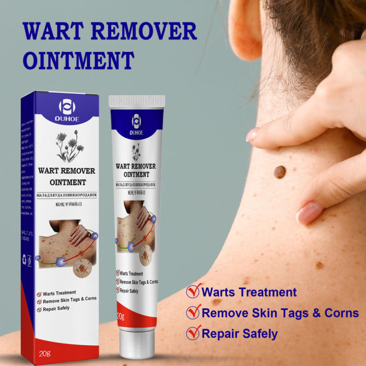Wart Removal Cream White Plantar Wart Cream Safe For All Skin Types ...