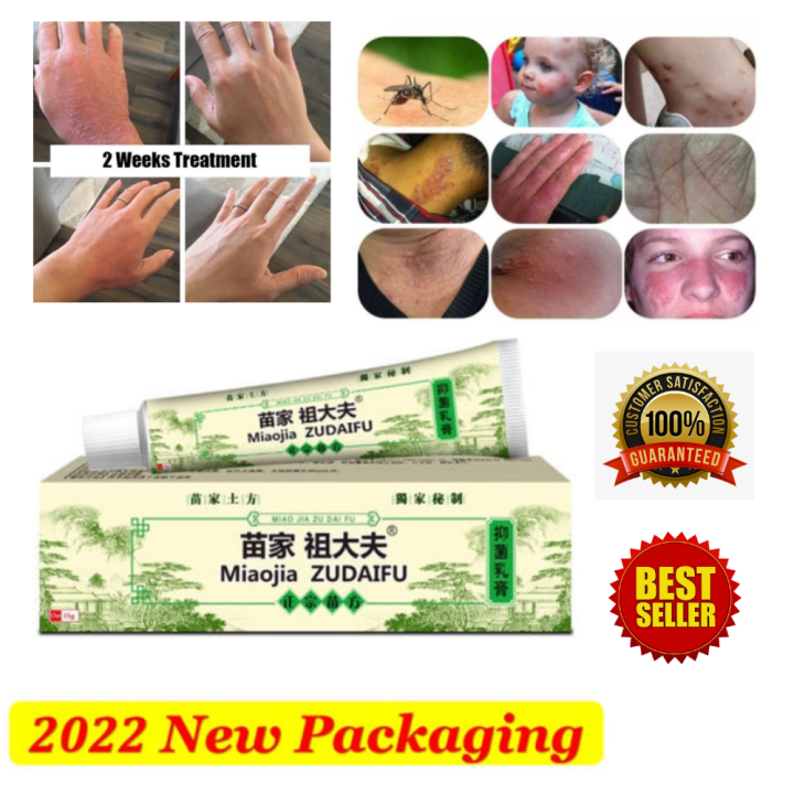 100% Organic Zudaifu Skin Herbal Cream Ointment Original Psoriasis Eczema Pruritus Itchiness ...