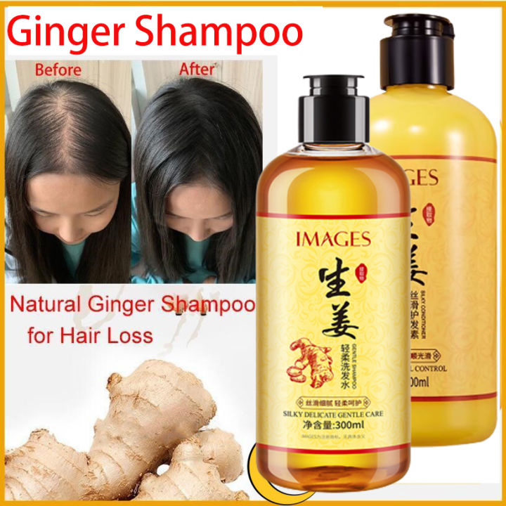 {100% Original} Ginger Anti-Dandruff Shampoo Hair Growth Oil Control Shampoo Hair Treatment ...