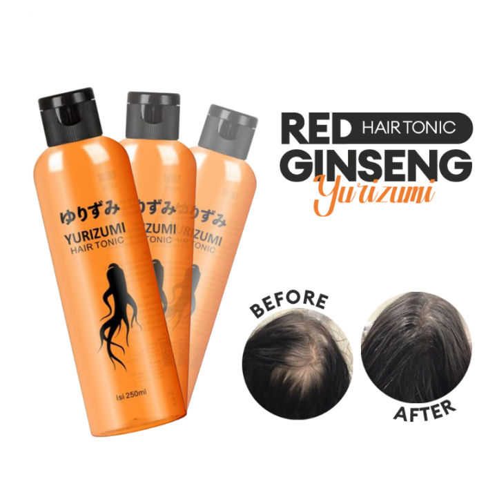 Obat Penumbuh Rambut Botak & Pitak Red Ginseng / Breylee / Lanbena Hair ...
