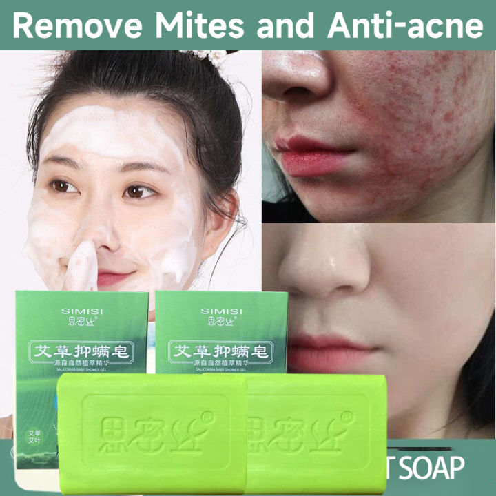 Herble Soap Anti Acne Soap Anti Pimples Eczema Skin Repair Acne ...