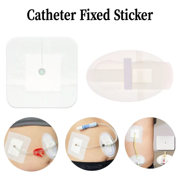 Medical Sterile Peritoneal Dialysis Catheter Fixed Patch Urinary ...
