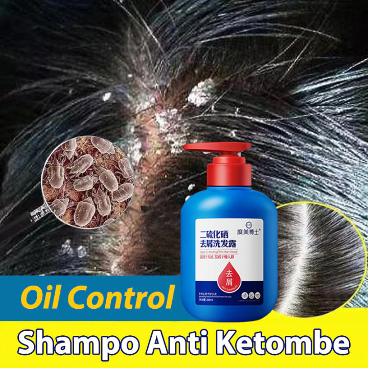 Anti dandruff shampoo，anti-itch shampoo，oil control shampoo,Makes hair ...