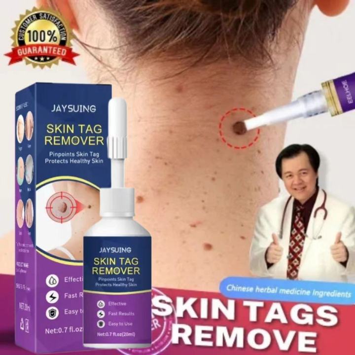 Jaysuing Obat Kutil paling ampuh oles obat tahi lalat paling ampuh ...