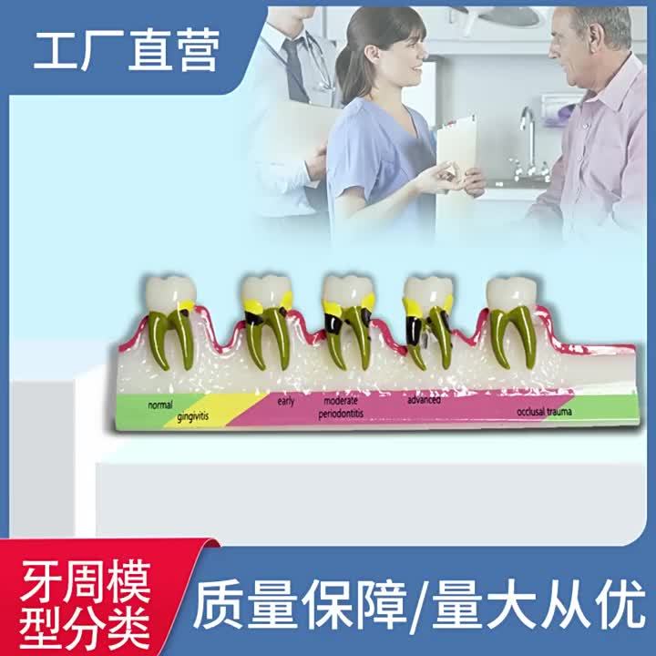 Dental Dental Decay Model Pit and Ditch Closed Model Tooth Decay ...