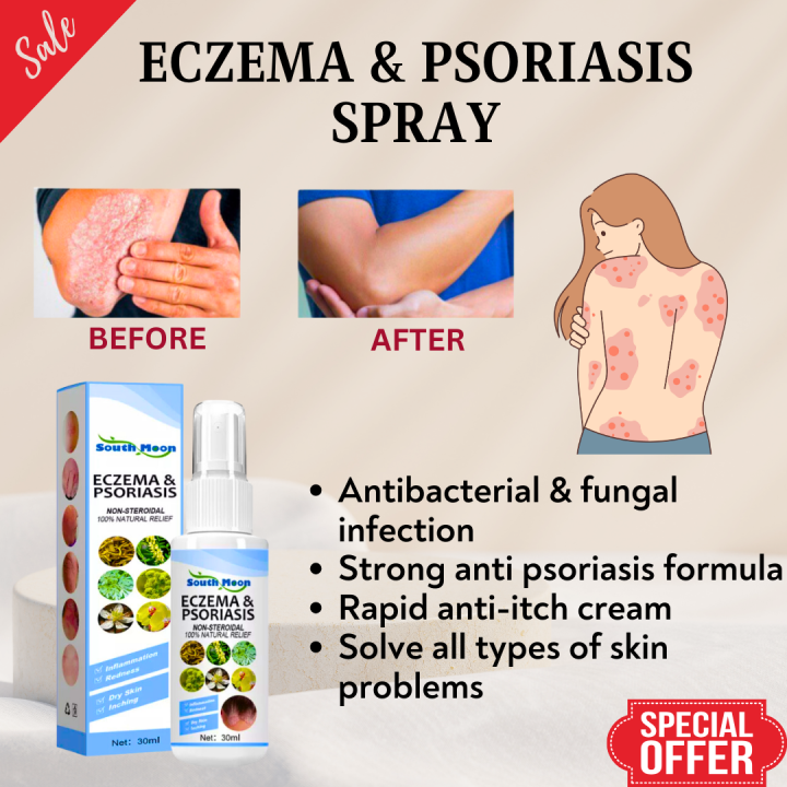 Eczema and psoriasis treatment spray for skin diseases antifungal, anti ...