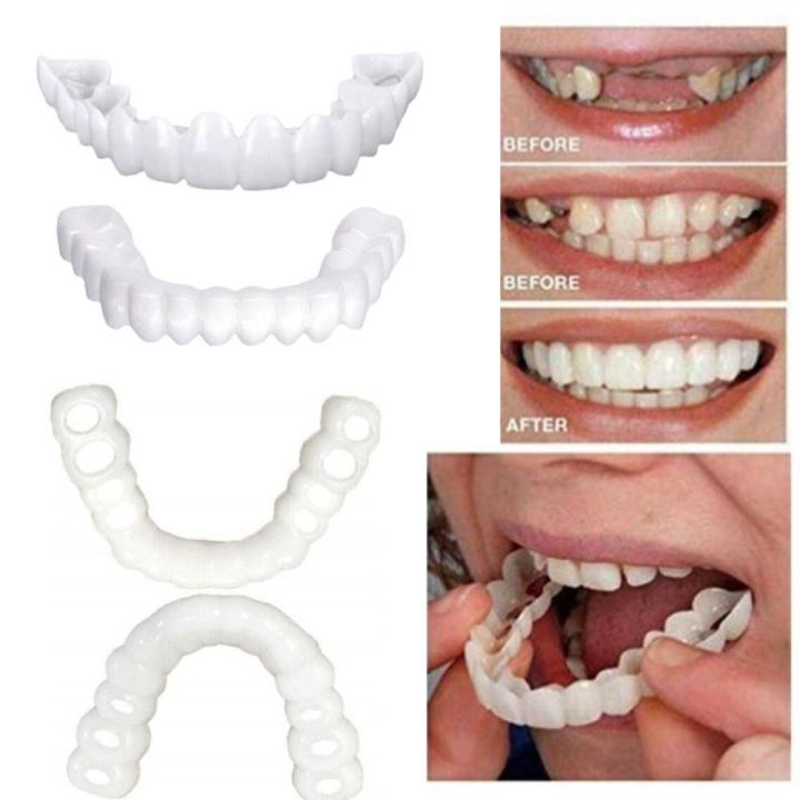 SAVAGE Instant Denture Teeth Top Veneer Cover Fake Teeth Sleeve ...