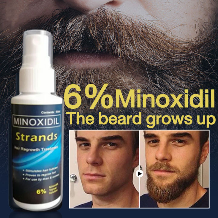 Bottled Spray Version Strands Minoxidil 6 Minoxidil Topical Solution