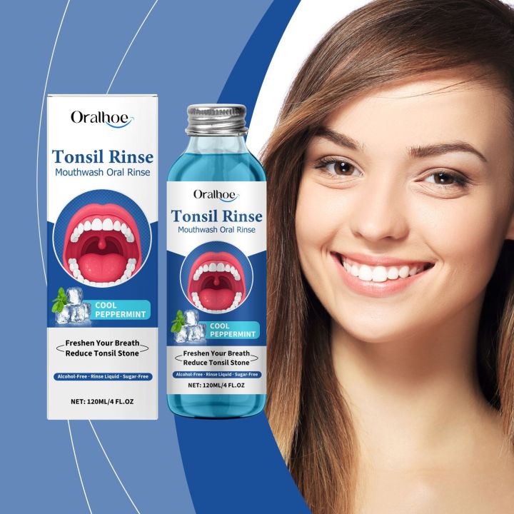 Tonsil Rinse Solution, Herbal Gum Protection, Cleaning and Odor, Fresh ...