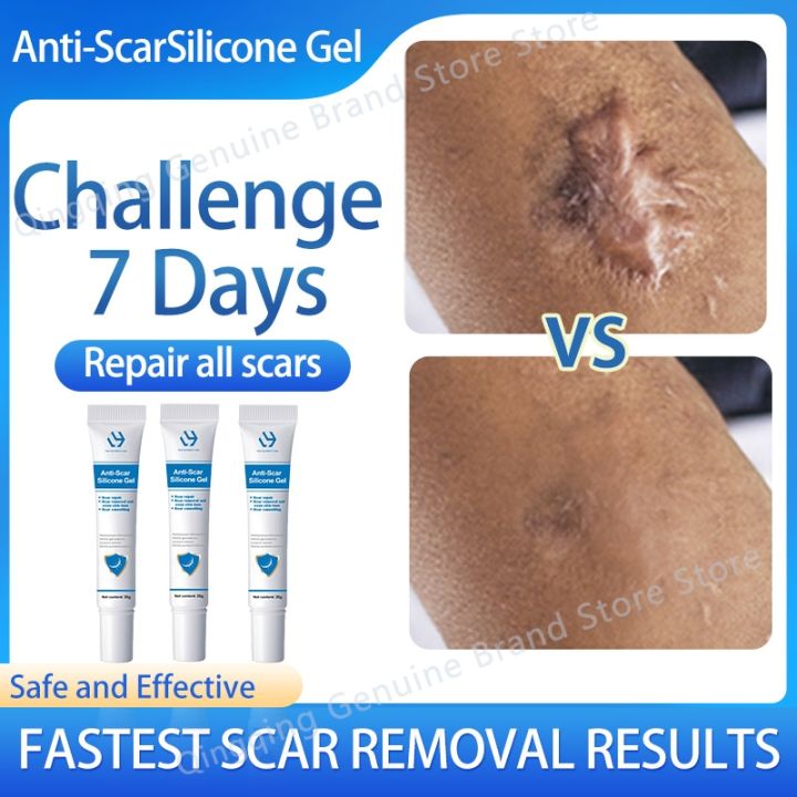 Scar cream gel effective repair surgical scars stretch marks acne pits pockmarks burn scars ...