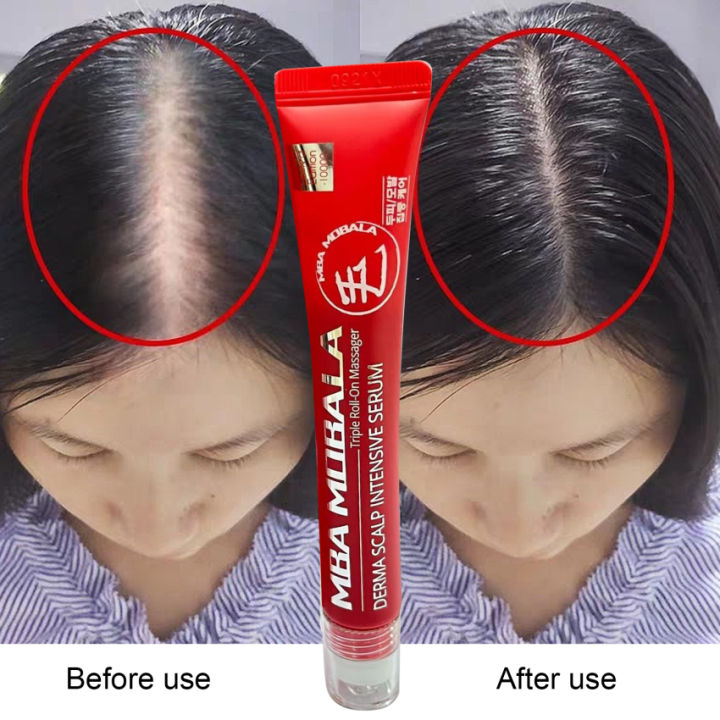 Fast Hair Growth Oil Hair Regrowth Serum for Women And Men Hair ...