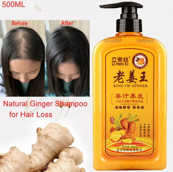 100% Original Ginger Hair Shampoo Anti Hair Loss Nourish Hair Fast Growth Shampoo Oil Control ...