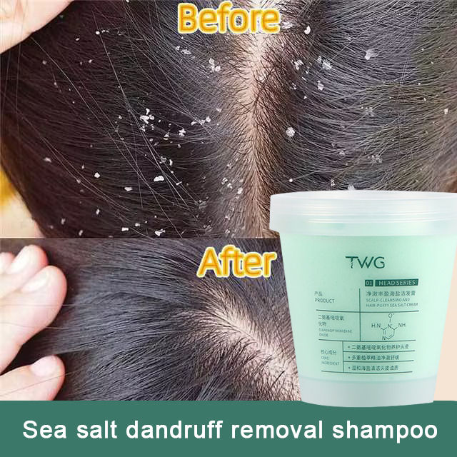 【7Days 100% Effective】250g Sea Salt Anti Dandruff Shampoo For Dandruff ...